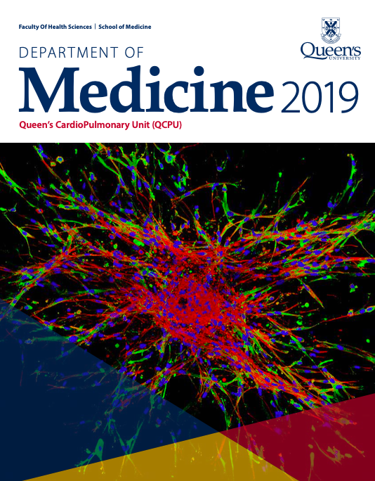 Queen's Cardio Pulmonary Unit (QCPU) | Department of Medicine | School ...